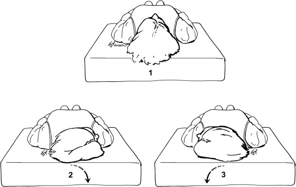 Supine roll test (Pagnini–McClure maneuver) – Ιωάννης Παπαδάκης